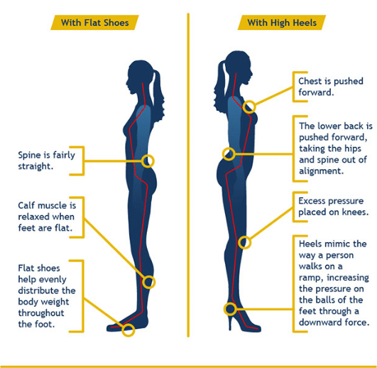 How to manage High Heel Pain | ME Physio