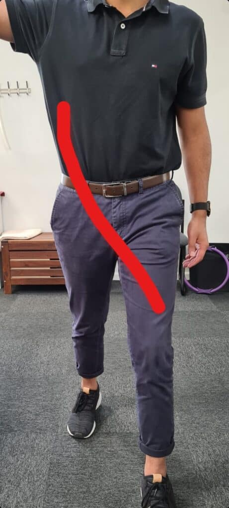 Anatomical slings: Enhancing movement and Stability