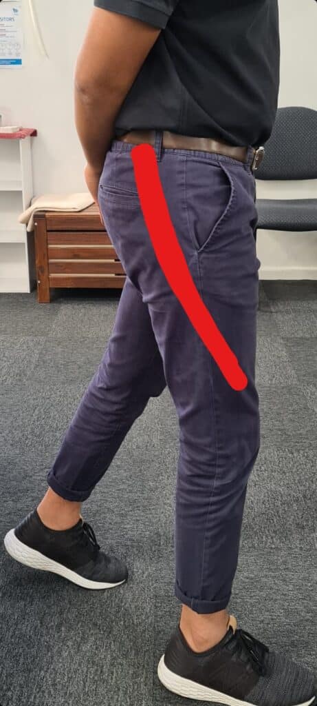 Anatomical slings: Enhancing movement and Stability